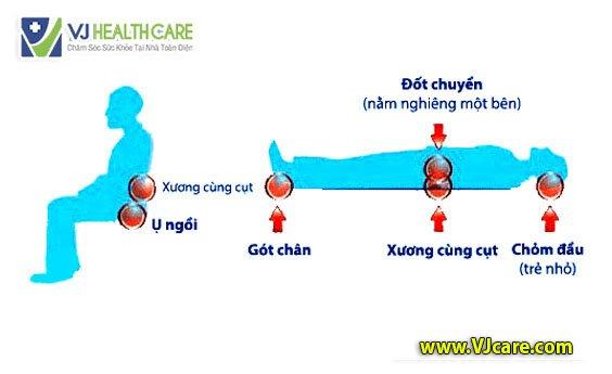 Loét tỳ đè vùng cùng cụt - Biến chứng nguy hiểm ở người nằm lâu